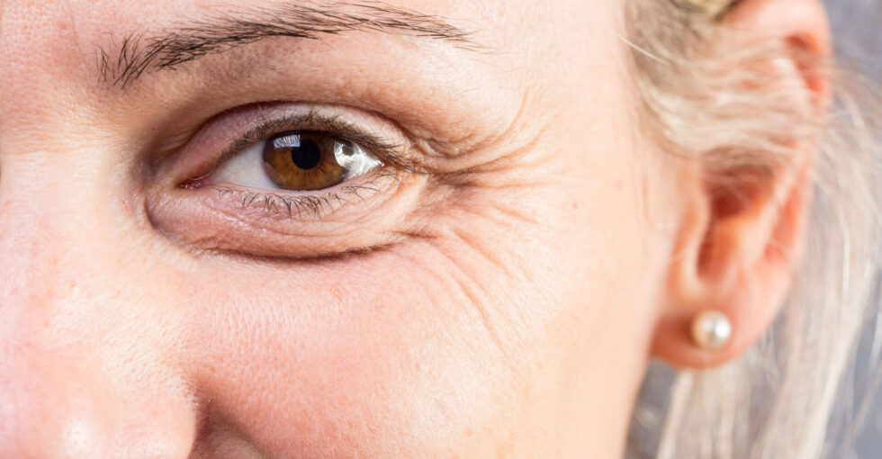 What is Bio Remodelling and Skin Boosters? - Dr Tass