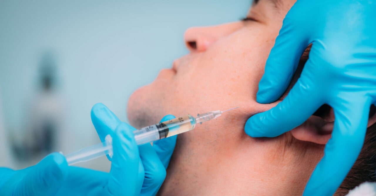 What Kind of Swelling Can I Expect After Dermal Filler? - Dr Tass